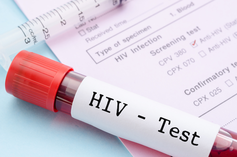 Anonymous HIV Testing | SEOCHC